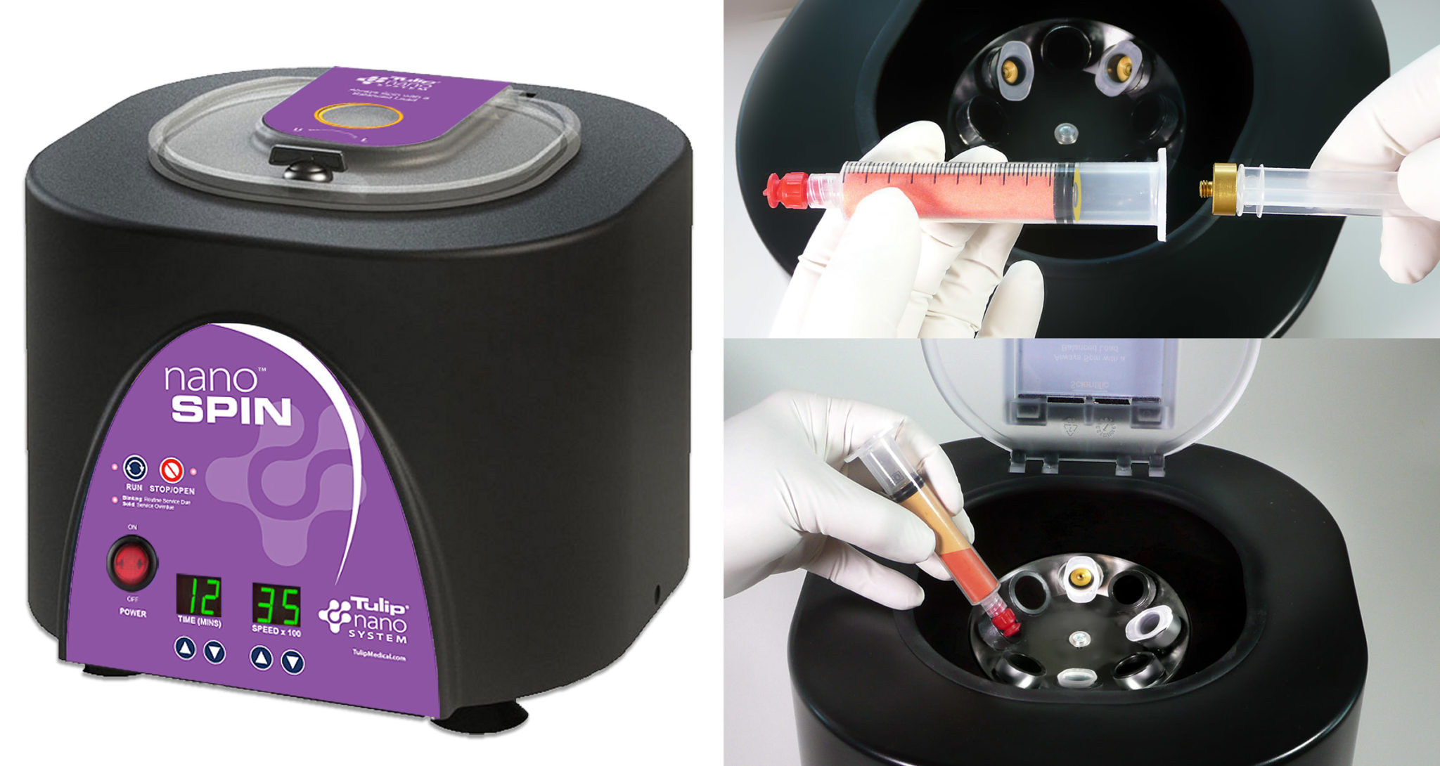 Tulip NanoSpin™ Zentrifugiersystem · GD Medical
