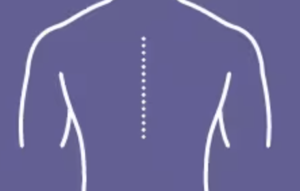 3M™ Prevena™ Therapy · GD Medical