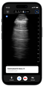 Butterfly POCUS systems · GD Medical