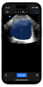 Butterfly POCUS systems · GD Medical