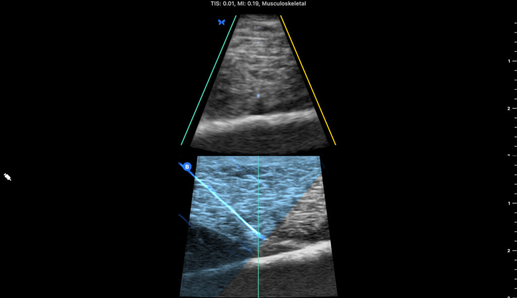 Butterfly POCUS systems · GD Medical