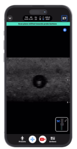 Butterfly POCUS systems · GD Medical