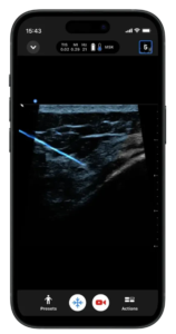 Butterfly POCUS systems · GD Medical