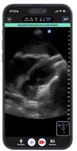 Butterfly POCUS systems · GD Medical