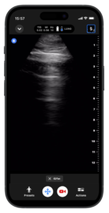 Butterfly POCUS systems · GD Medical