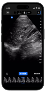 Butterfly POCUS systems · GD Medical